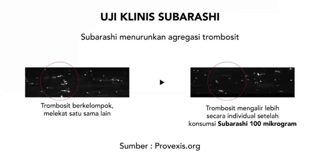 SOP SUBARASHI dari AFC - Selamat Datang di LifeScienceIndonesia.com